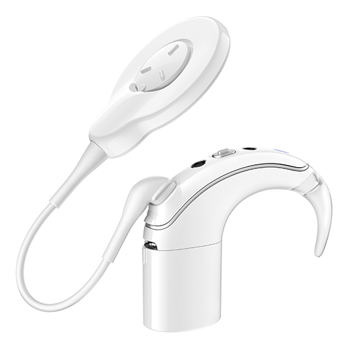 Nucleus 7 Sound Processor – Digital Ears Audiology Center